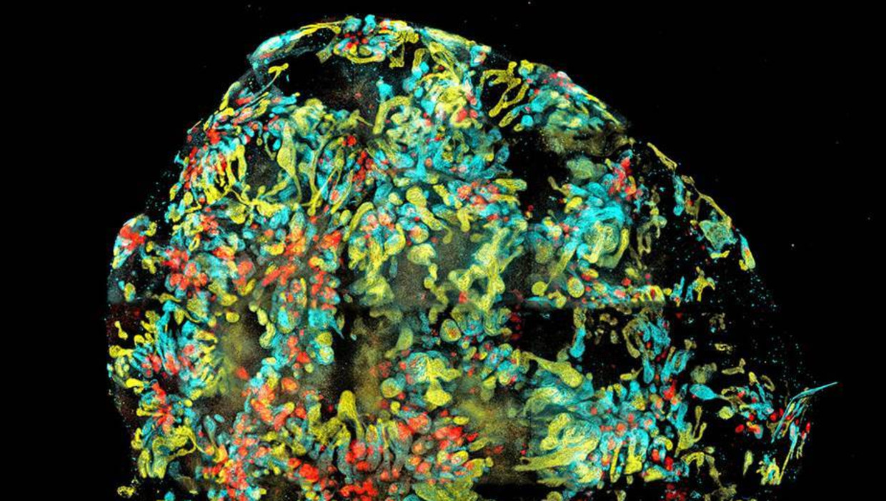 Wetenschappers kweken nier uit huidcellen | De Volkskrant