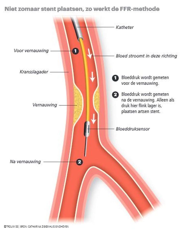 Gerichter dotteren redt levens | Trouw