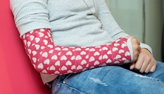 Arm gebroken? Maasstad introduceert kleurrijk gips | Rotterdam | AD.nl