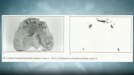 Is een jongen van vijf de dader? - Moordzaken: Wetsdokters